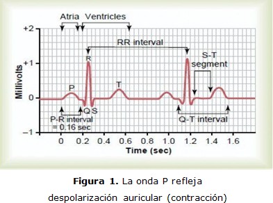 Patrón electrocardiográfico Breijo | Breijo-Márquez | Archivo Médico Camagüey