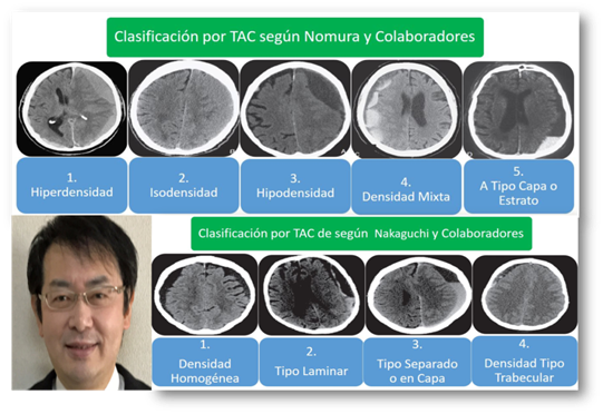 Evaluación multimodal del hematoma subdural crónico | Mosquera ...
