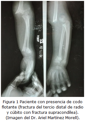 Situaciones transoperatorias en pacientes pediátricos con fractura ...